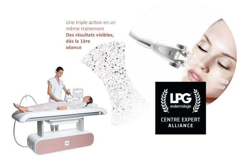 Soin LPG à Paris 14ème : Centre expert LPG Alliance